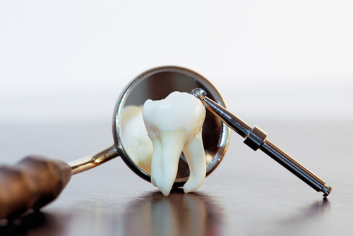 Tooth Extractions for Rockledge and Beyond - Premier Walk-in Dental Blog